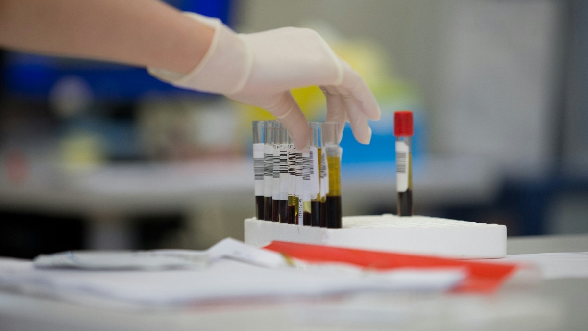 New blood test could spot Alzheimer's disease before symptoms appear
