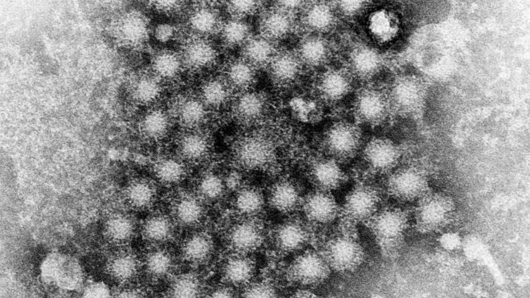 Parents told to check children's handwashing after hepatitis A outbreak