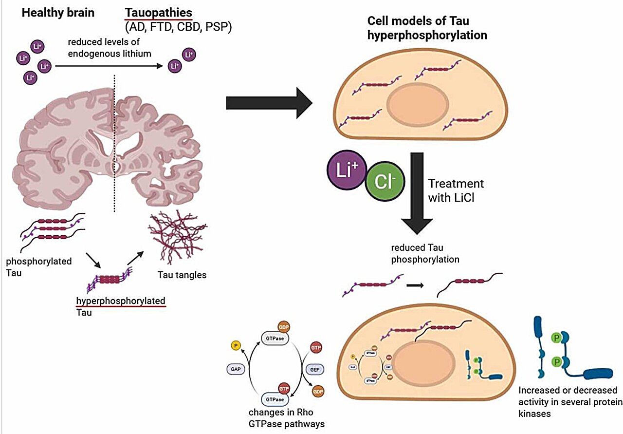 Lithium uncovers fresh Alzheimer's targets beyond tau