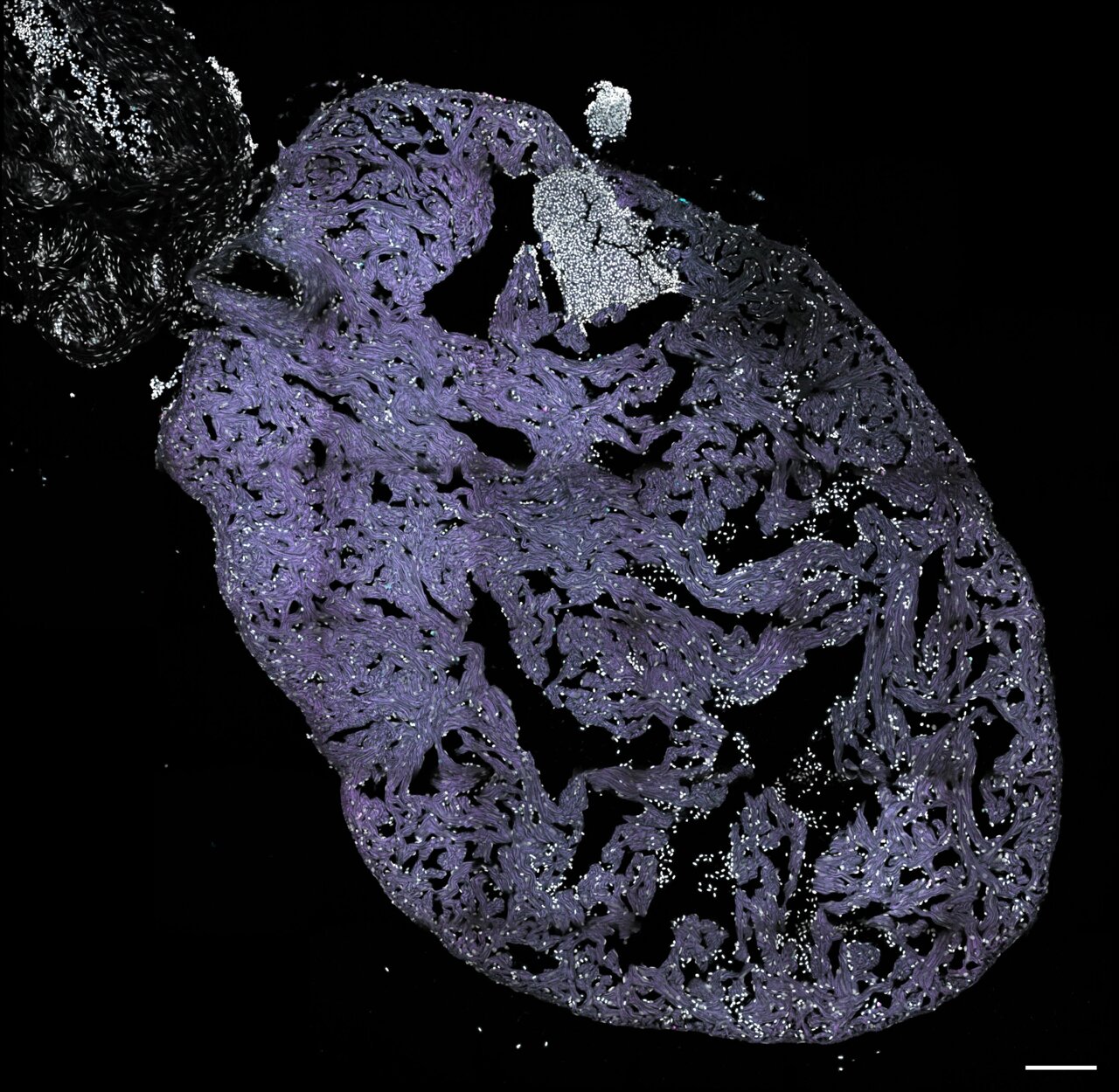 Why zebrafish hearts heal so well: Early immune signals can improve ...