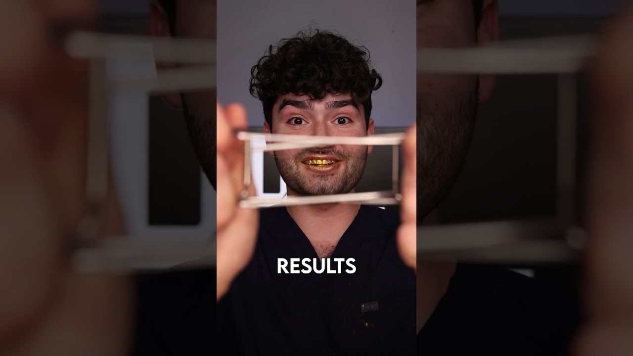 Gold ASMR snacks vs cavities?