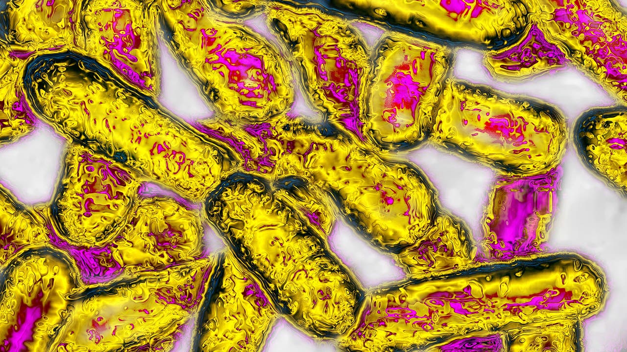 Public health officials confirm 18 Legionella infections connected to ...