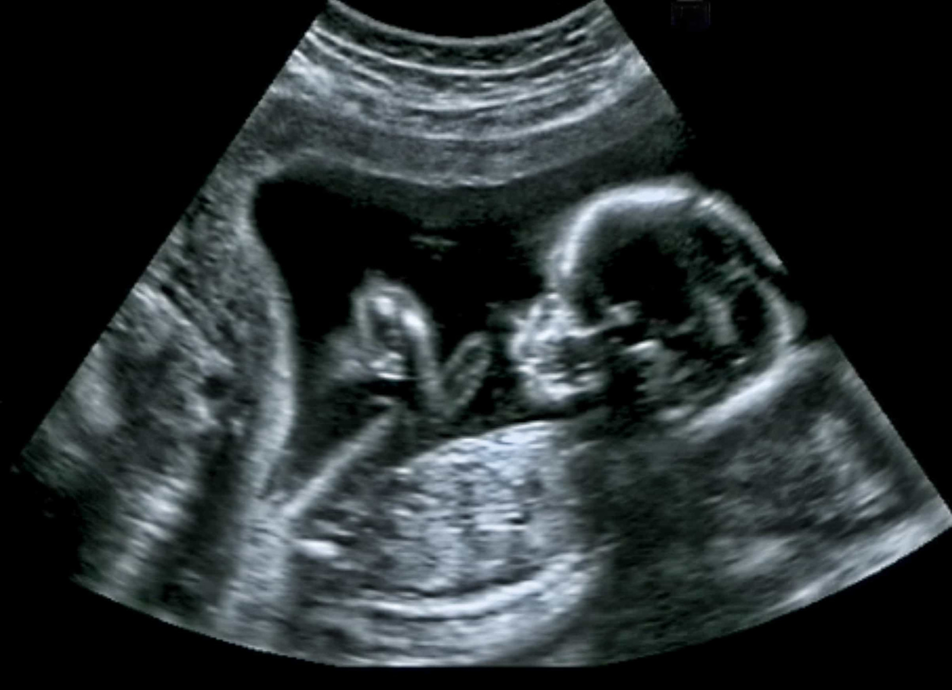 Touch deprivation: why we all need human touch