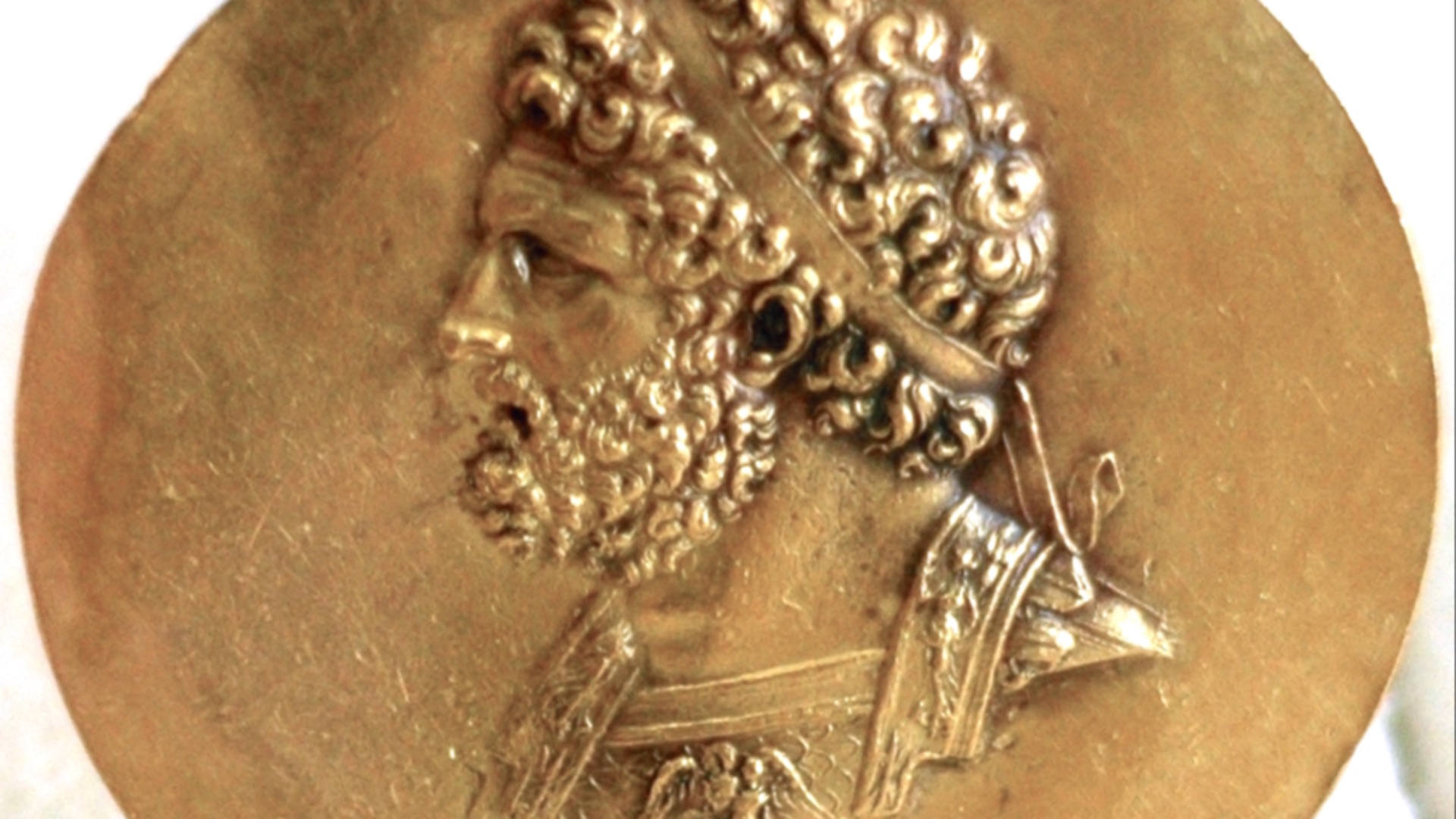 20 historical figures you didn't know were missing body parts