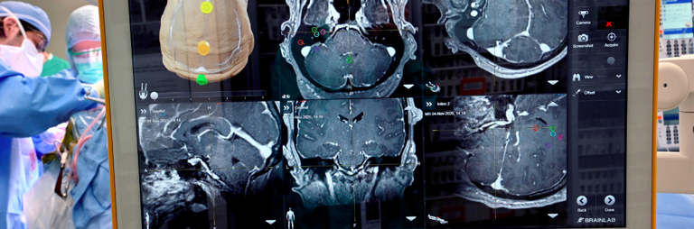 World’s first BCI technology targets high-level brain function to ...