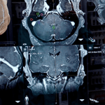 World’s first BCI technology targets high-level brain function to ...