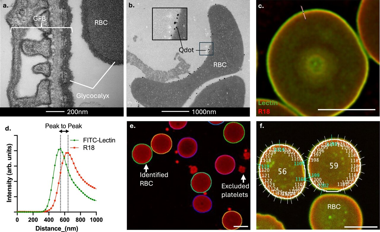 Blood test enables earlier detection of heart and kidney disease