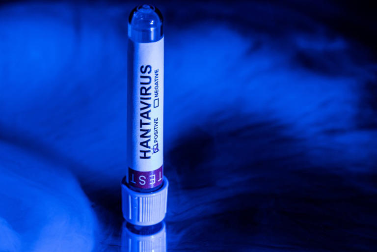 Iowa health officials downplay hantavirus concerns, not a COVID-19 repeat