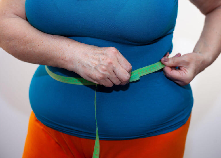 6 early signs of PCOS that are often overlooked