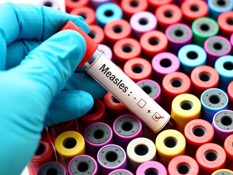 Potential measles exposure at Nassau County restaurant, health ...