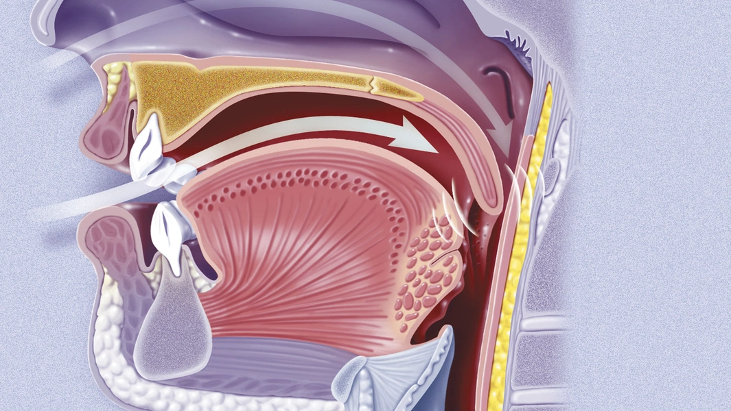 Why your snoring might be a wake-up call