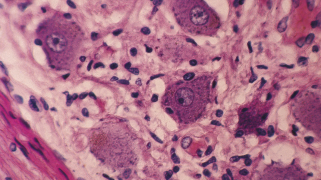Study reveals early cell fate decisions in human nerve development