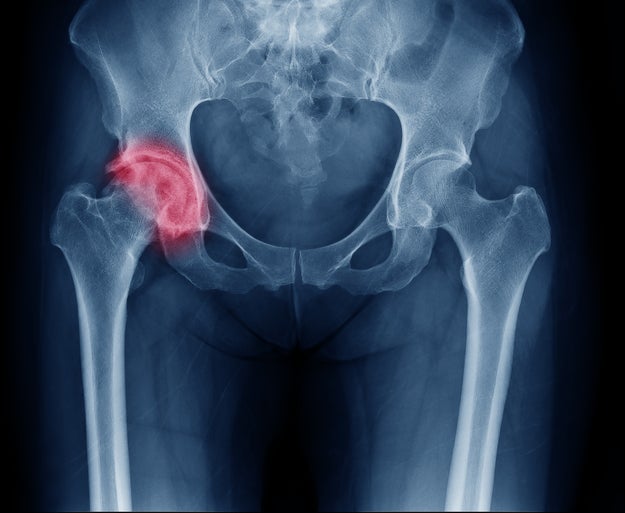 Struggling to balance on one leg? Here’s what it could say about your ...