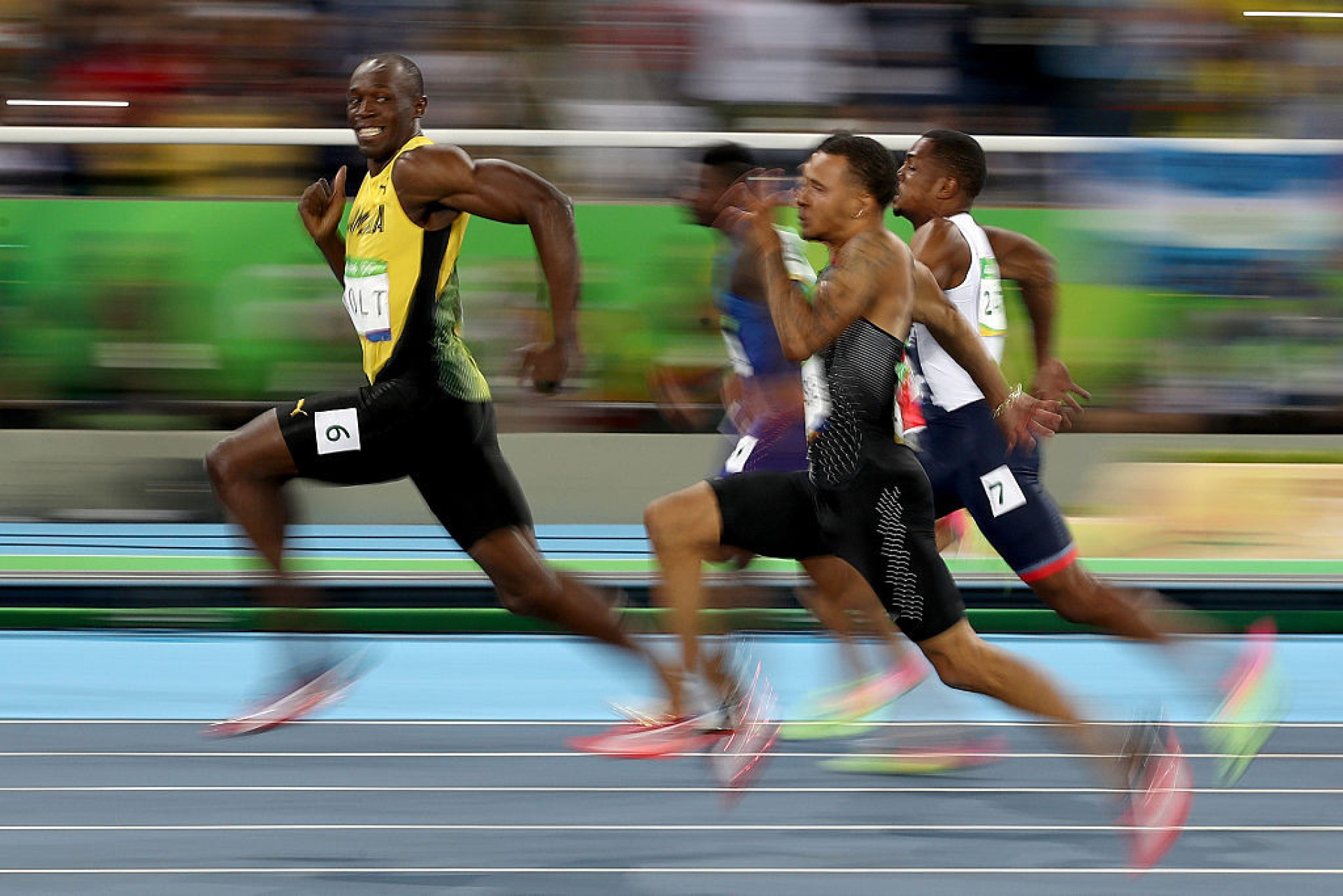 La scoliosi e le celebrità affette da questa deformità della colonna ...