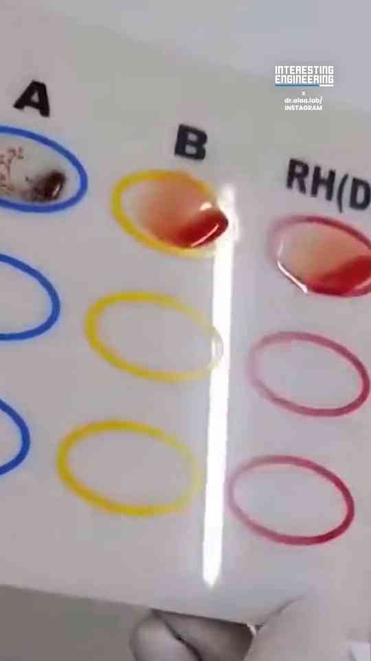 The science behind blood typing