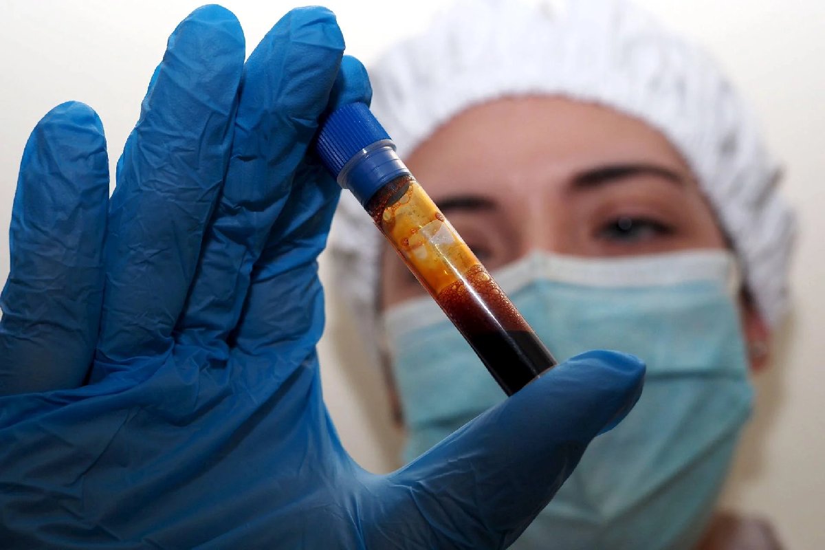Oms, emergenza internazionale per raro ceppo di ebola. L’esperto: "Un ...