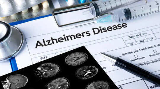 When should you get tested for Alzheimer’s? Doctors say these memory ...