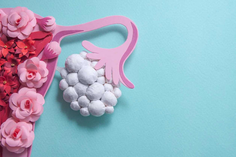 What is PCOS and why is changing its name to PMOS such a big deal?