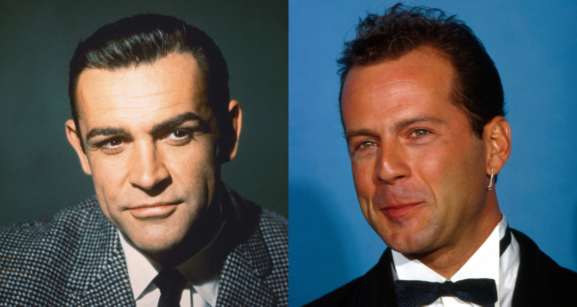Bald celebrities when they had hair