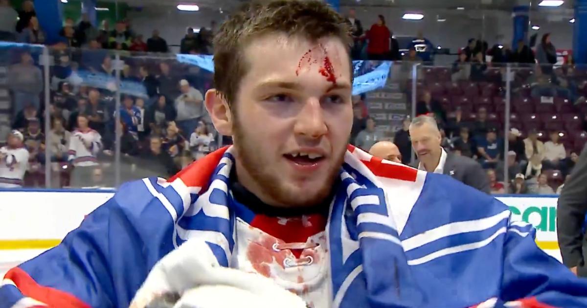 Championship celebration turns bloody for Dylan Edwards and the Rangers!