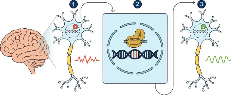 Researchers successfully treat hereditary epilepsy in a mouse model