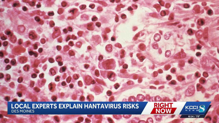 Iowa health experts explain how hantavirus spreads and why risk is low