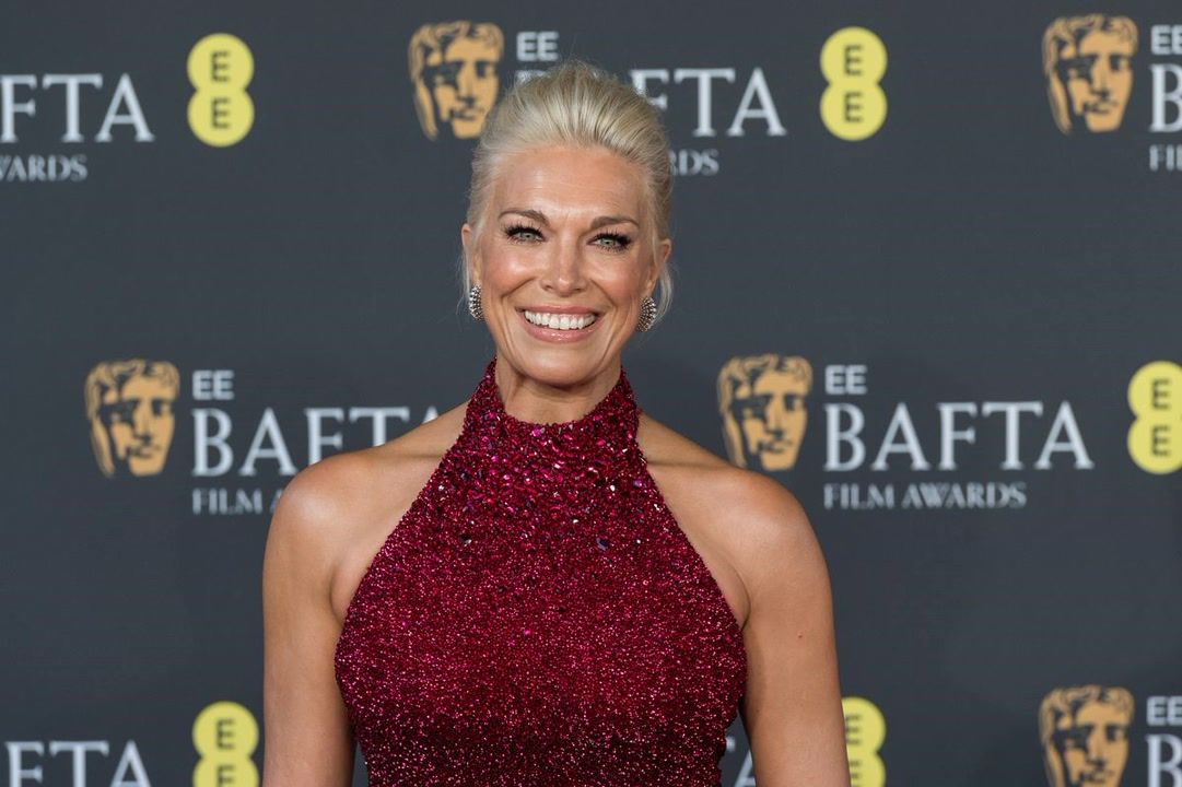 Hannah Waddingham opens up about photoshoot trauma
