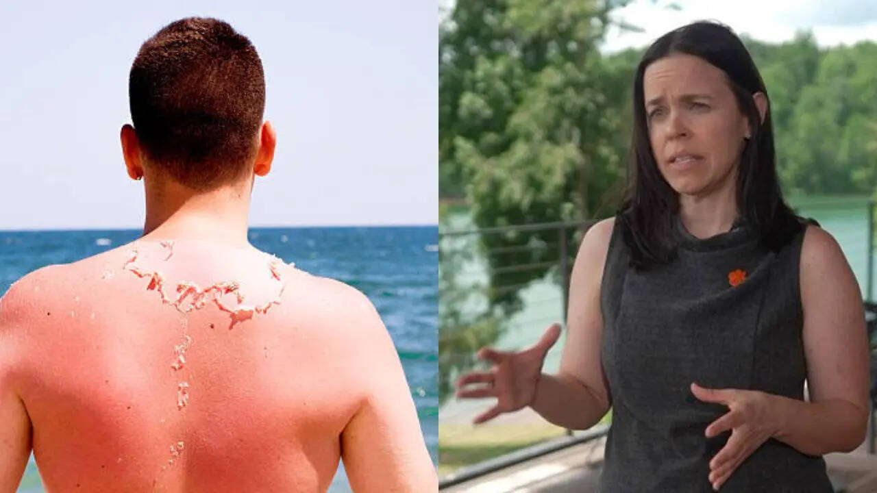Top US professor warns just 20 minutes of excess sun exposure could ...