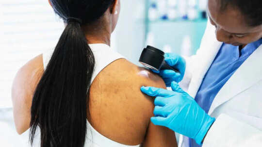 Top US professor warns just 20 minutes of excess sun exposure could ...
