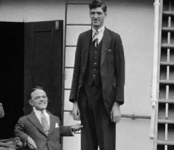 De enano a gigante: La transformación de ese hombre conmocionó la medicina