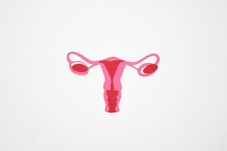 PCOS has been renamed to PMOS – here’s what that means for your health