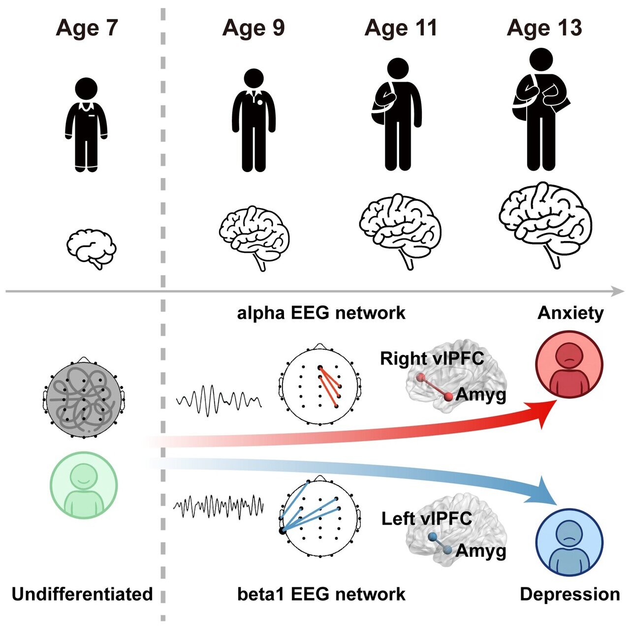Brain-wave patterns at age 9 may predict anxiety and depression