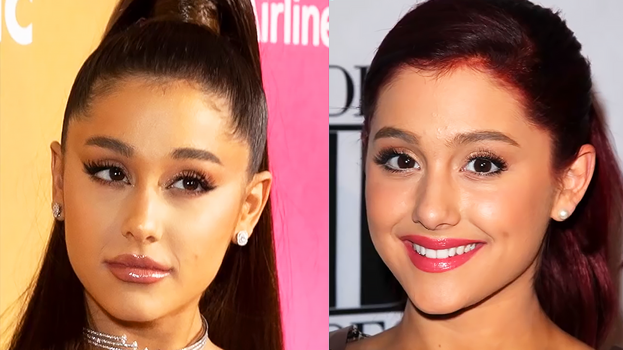 Plastic surgeon explains celebrity lip injections