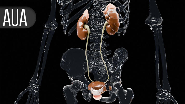 No prostate cancer survival benefit with more extensive lymph node ...