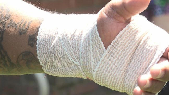 Rochester man who was pepper-sprayed, stunned with Taser by federal ...