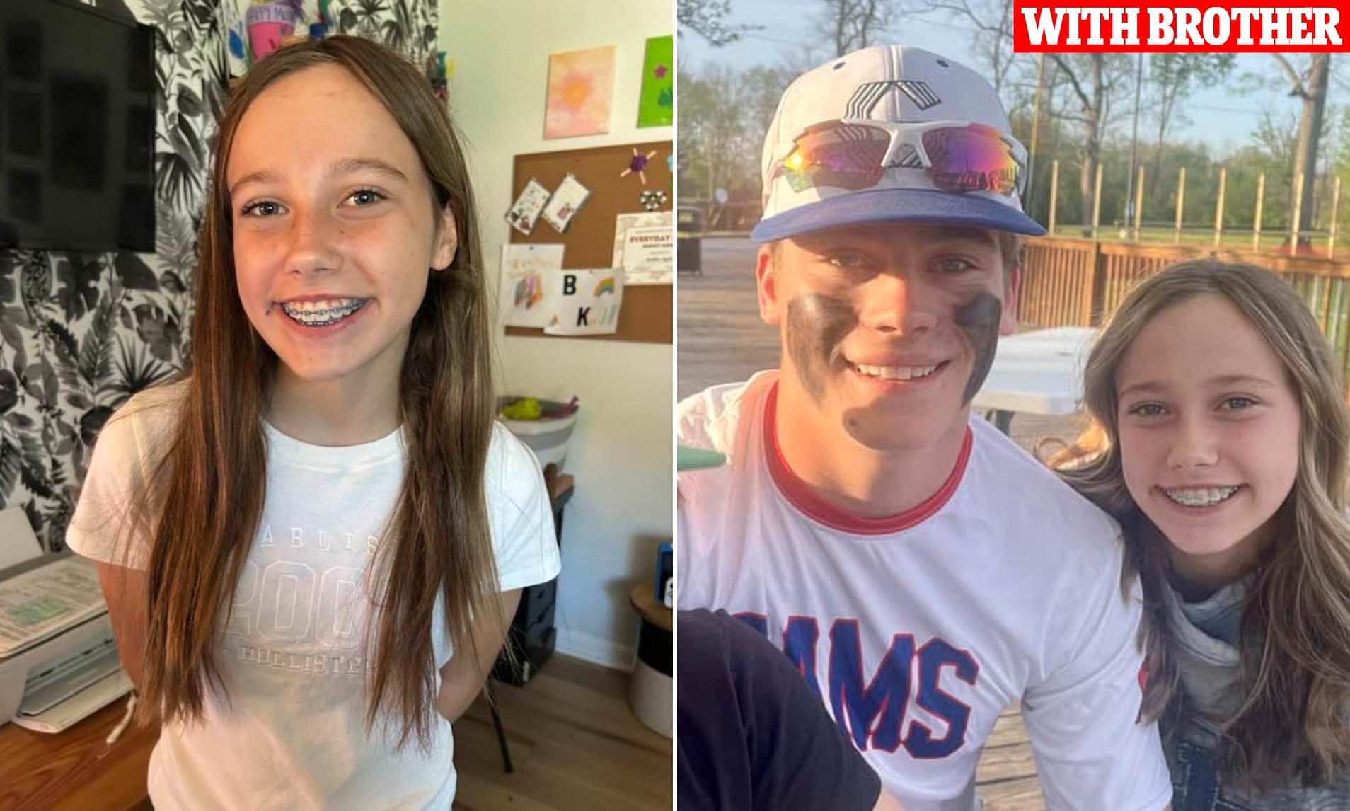 Schoolgirl horrifically burned after classroom science experiment went ...