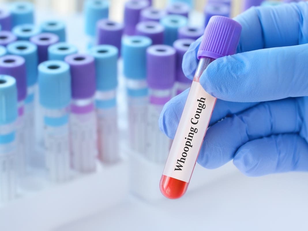 Whooping cough outbreak hits Pasadena school