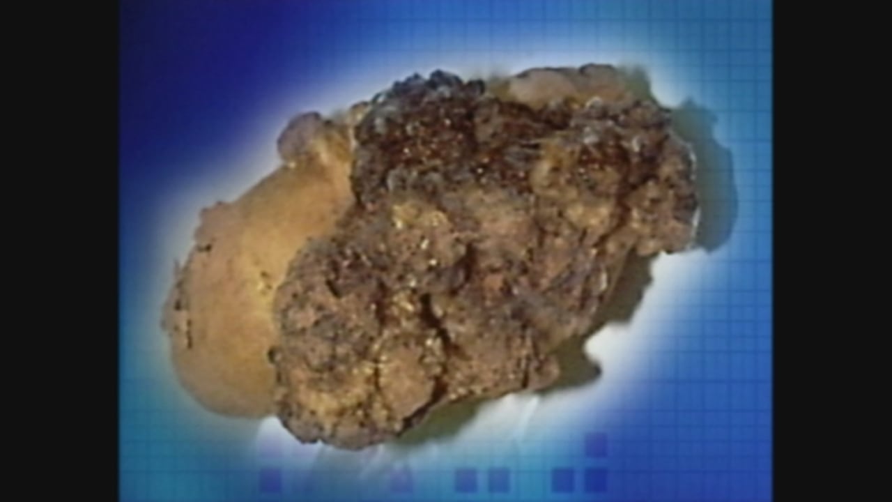 For the first time in 3 years, potato wart has been detected on a PEI farm