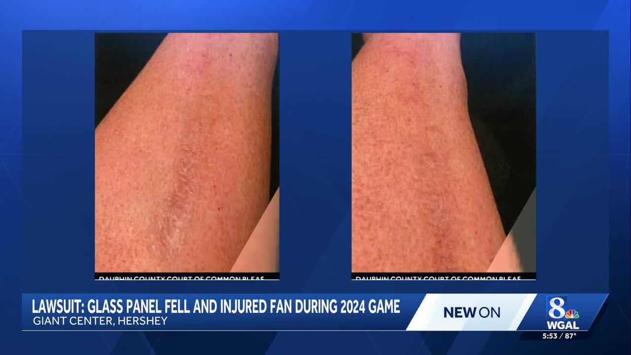 Woman sues Hershey Entertainment after ice arena glass falls during game