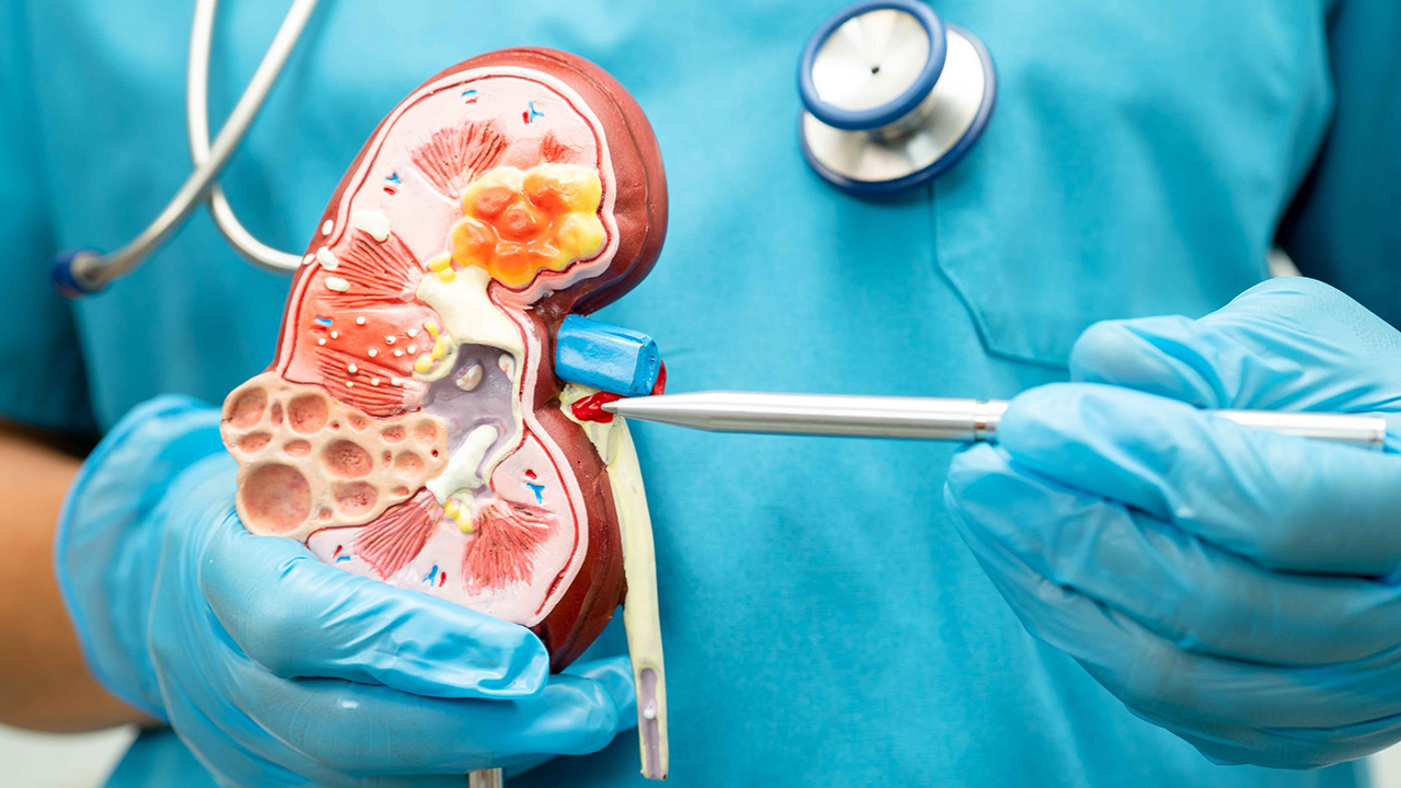 8 early warning signs you may be suffering from chronic kidney disease