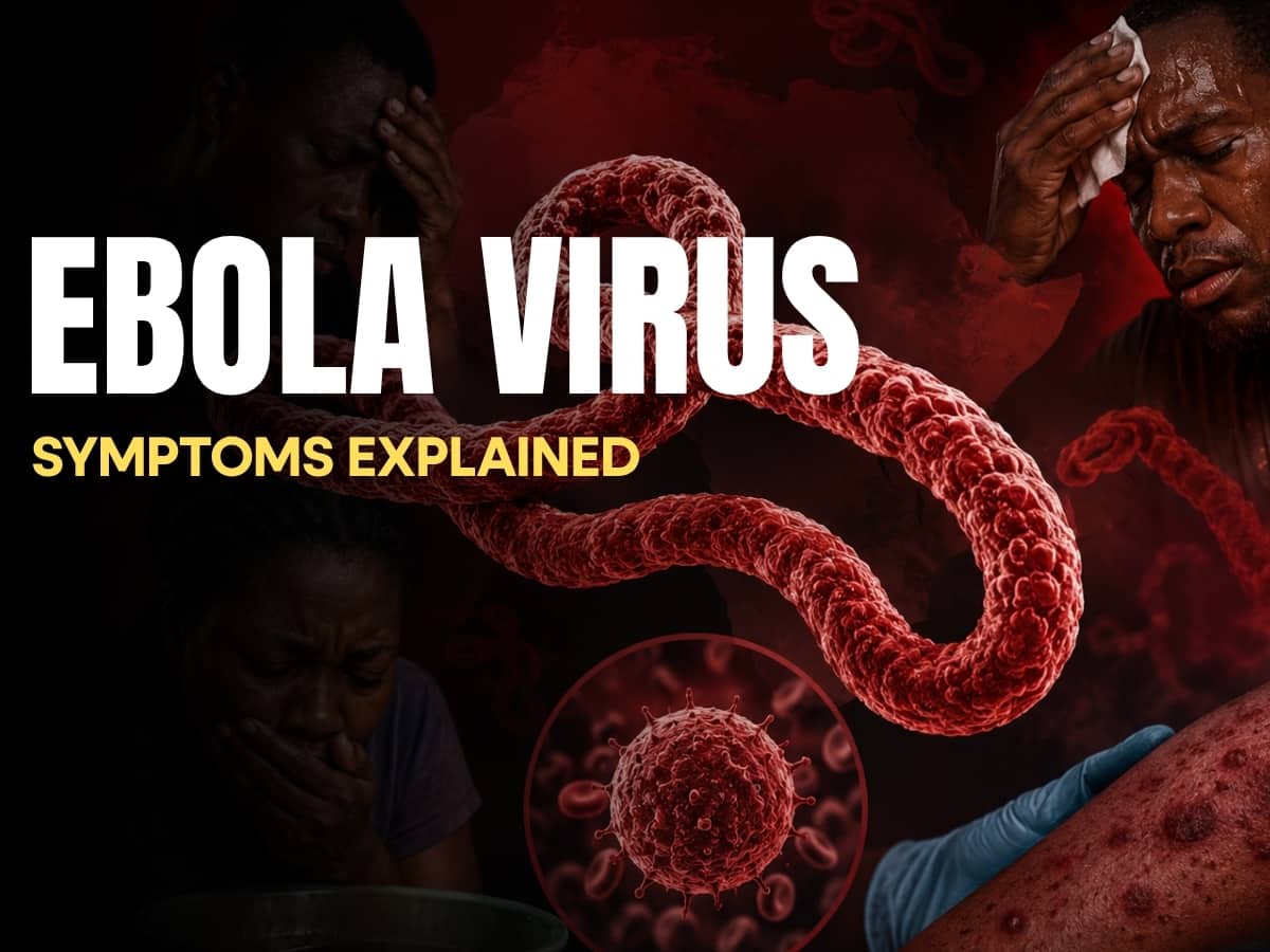 Ebola virus outbreak: 5 symptoms of this deadly virus that killed over ...
