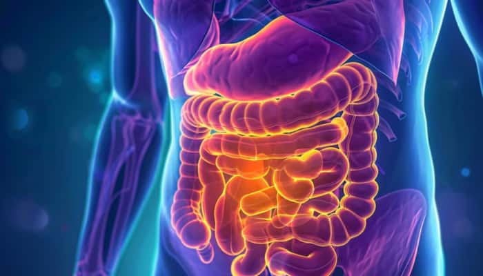 Gut health is the new wellness trend, but are you ignoring IBS symptoms?