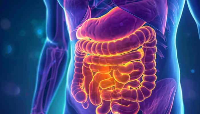Gut health is the new wellness trend, but are you ignoring IBS symptoms?