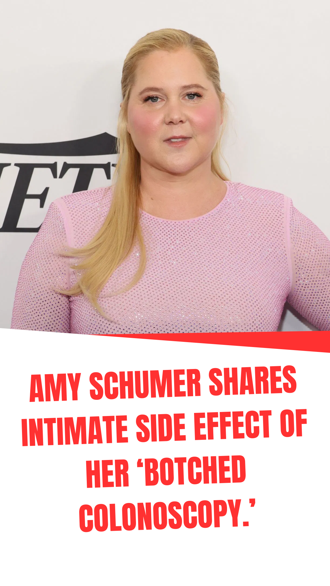 Amy Schumer shares intimate side effect of her 'botched colonoscopy'