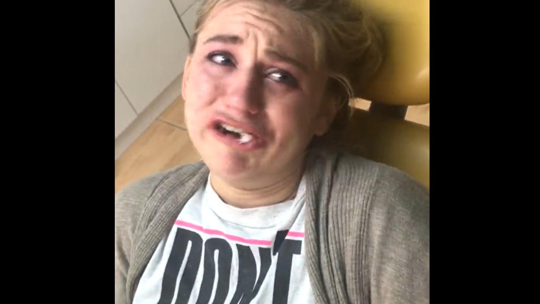 Wisdom teeth anesthesia