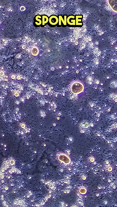 What a kitchen sponge reveals under the microscope is wild