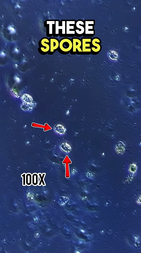 What plant fungus really looks like under a microscope
