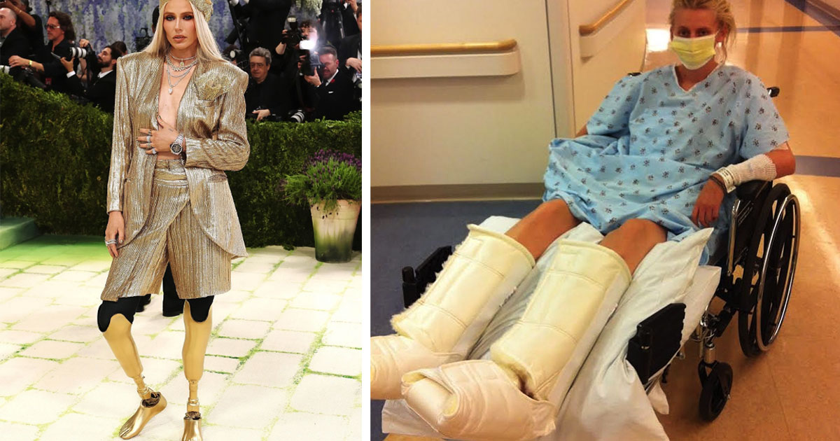 Model with "golden legs" has scary tampon warning after losing both ...