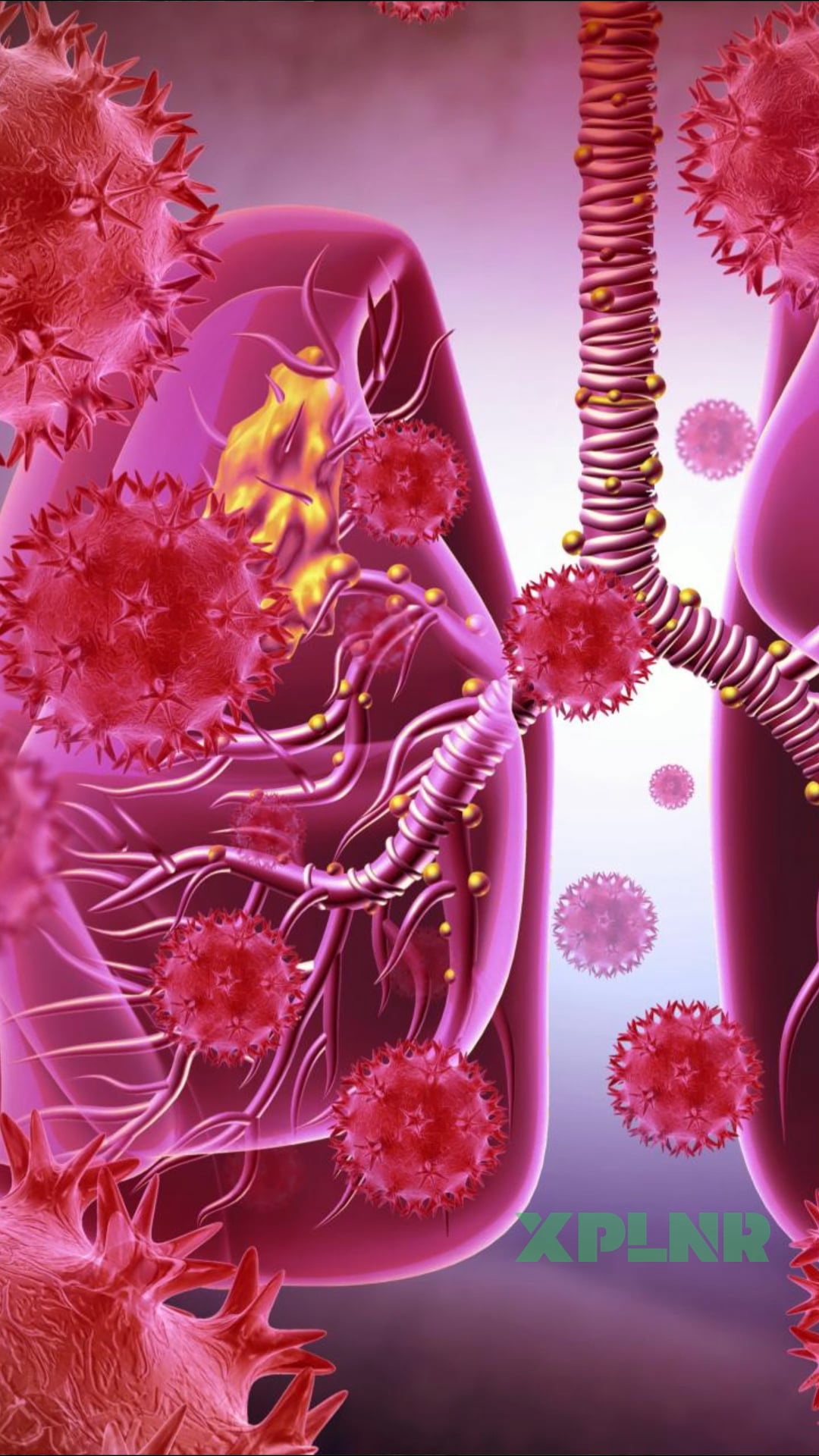 Are infectious diseases more dangerous now? The reality of modern virus ...