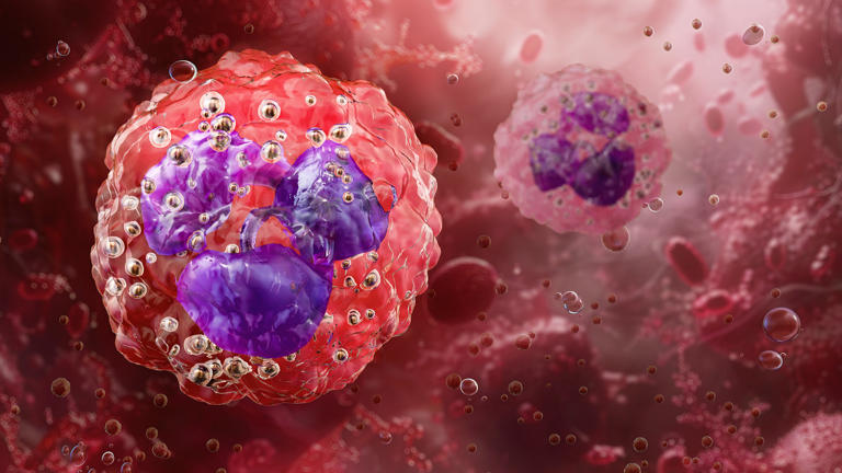 Common asthma drug helps fight hard-to-treat cancers, early study finds
